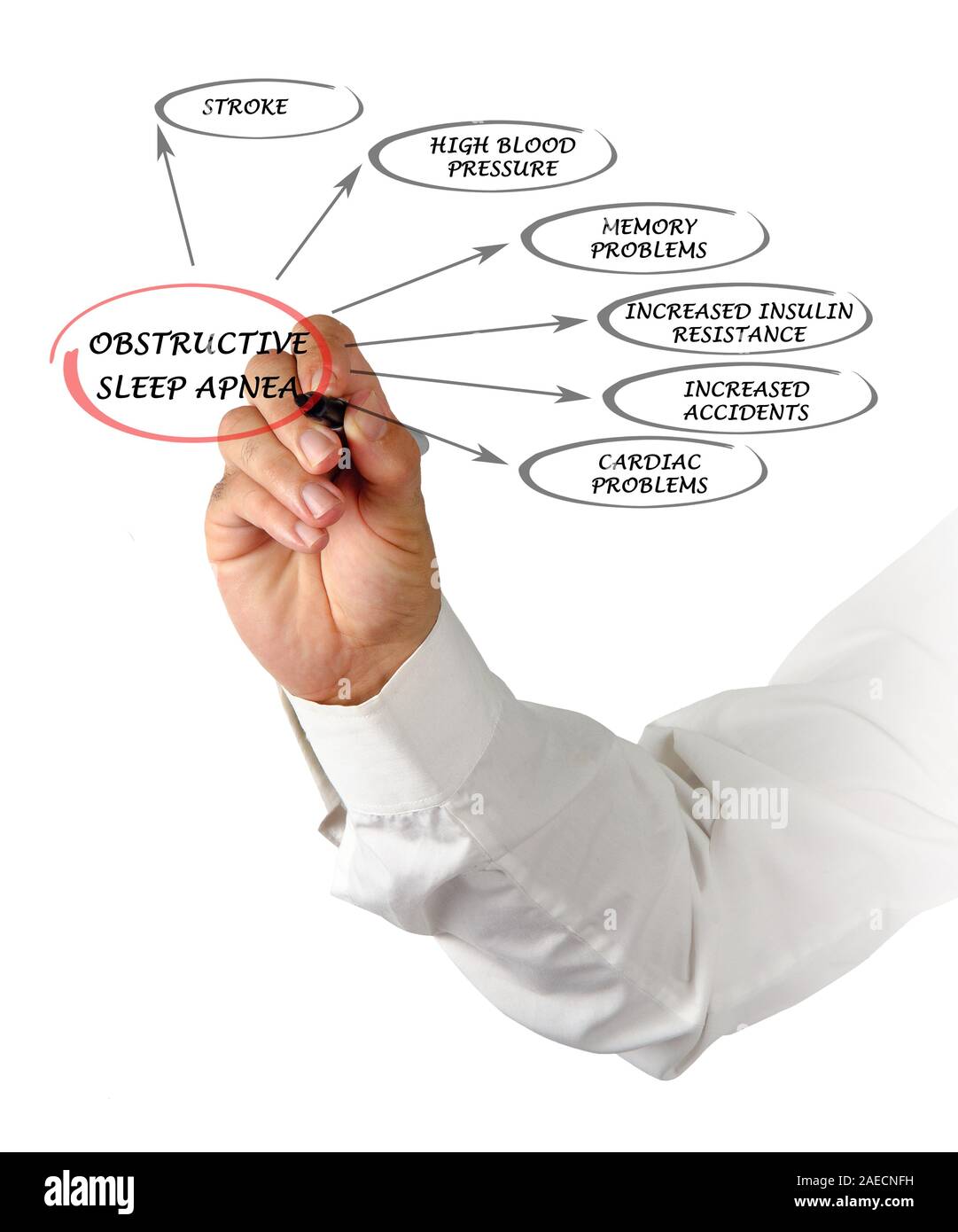 Obstructive Sleep Apnea Stock Photo - Alamy