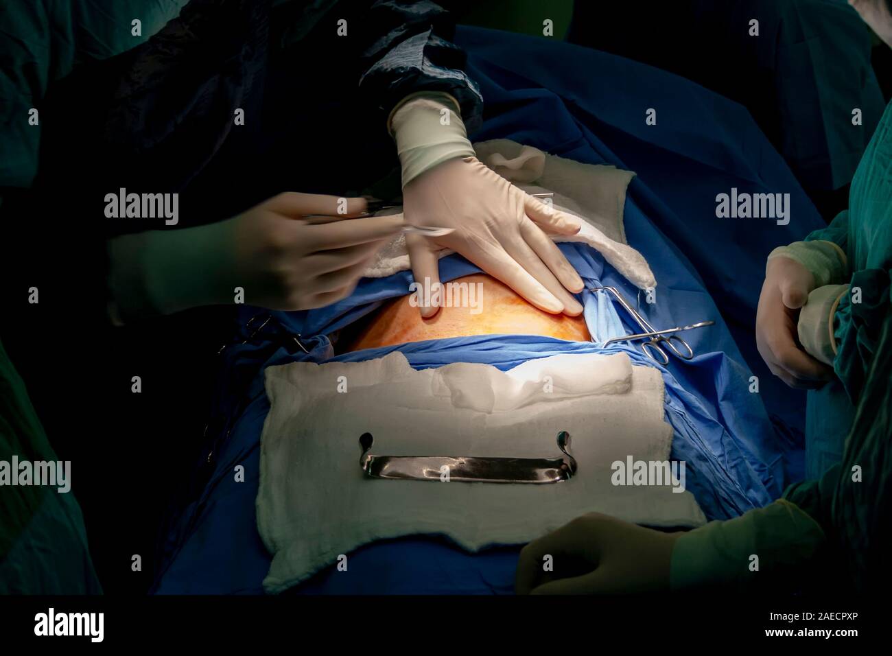 Video Of Baby Delivery Operation at Esperanza Bruns blog