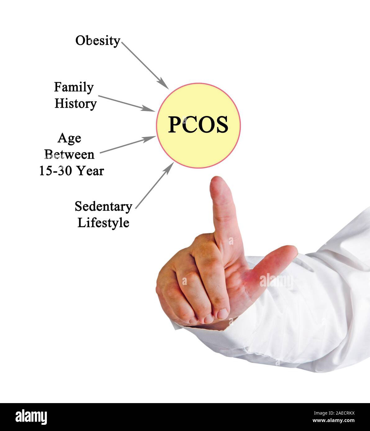 Polycystic Ovarian Syndrome Stock Photo - Alamy