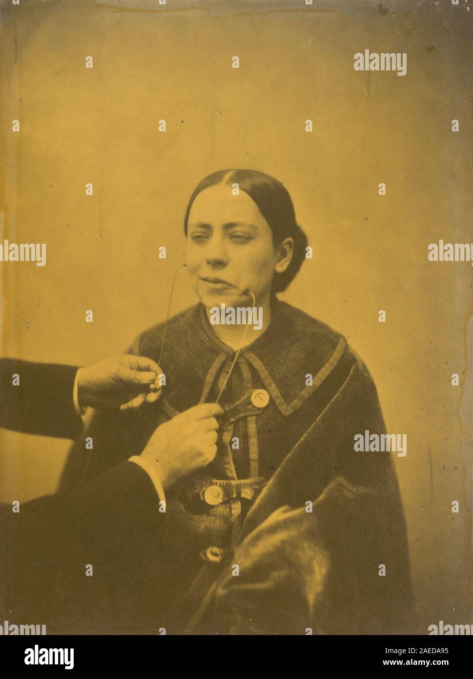 A work by Guillaume-Benjamin-Amant Duchenne showing two facial ...