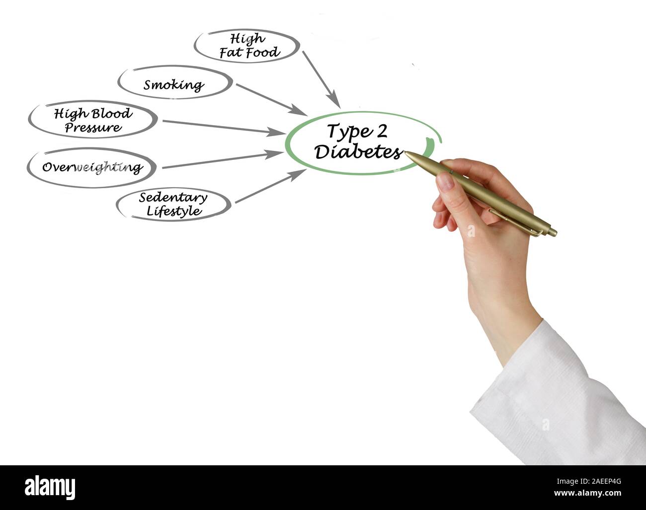 Type 2 diabetes diagram hi-res stock photography and images - Alamy