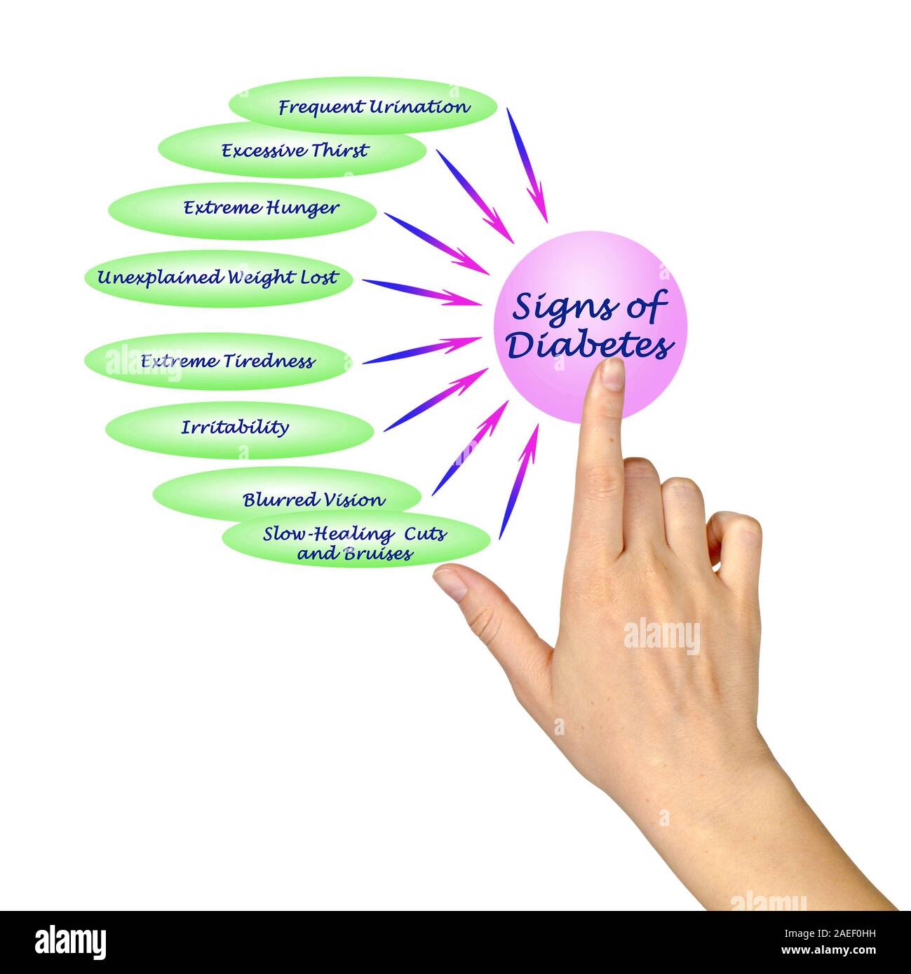 Sign of diabetes Stock Photo - Alamy
