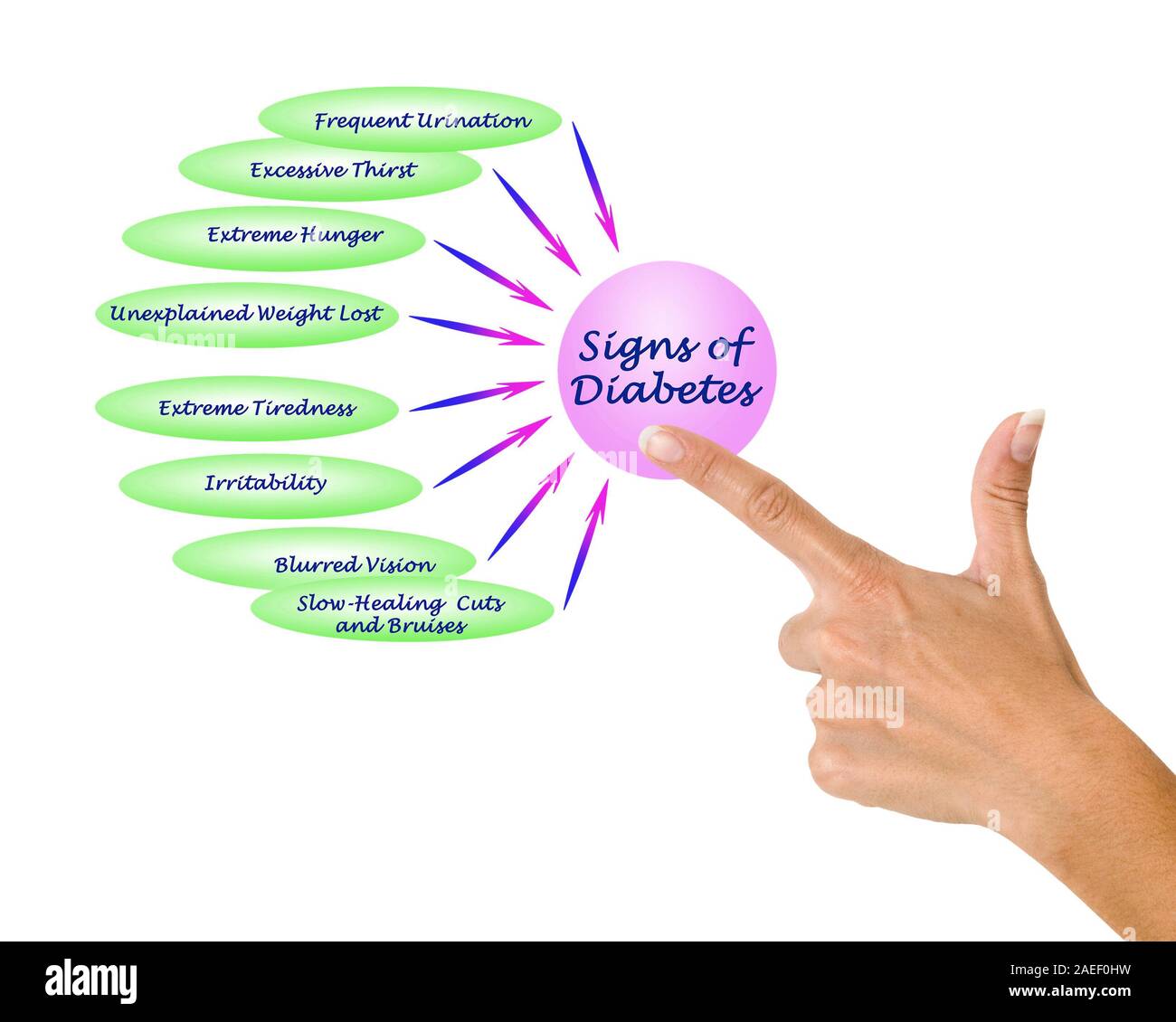 Sign of diabetes Stock Photo - Alamy