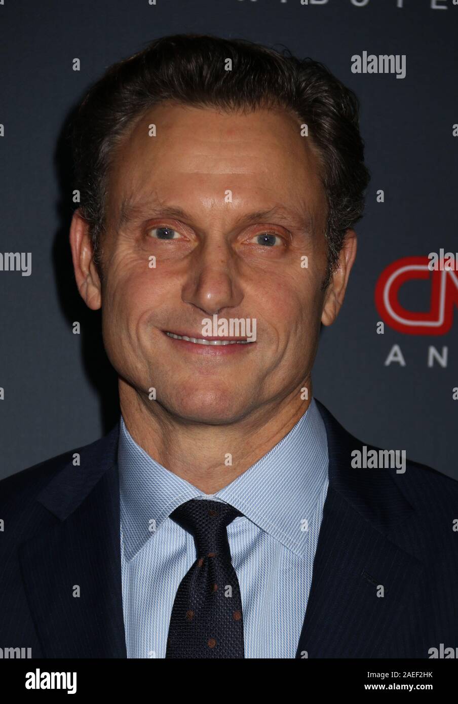 Tony Goldwyn No Eyebrows