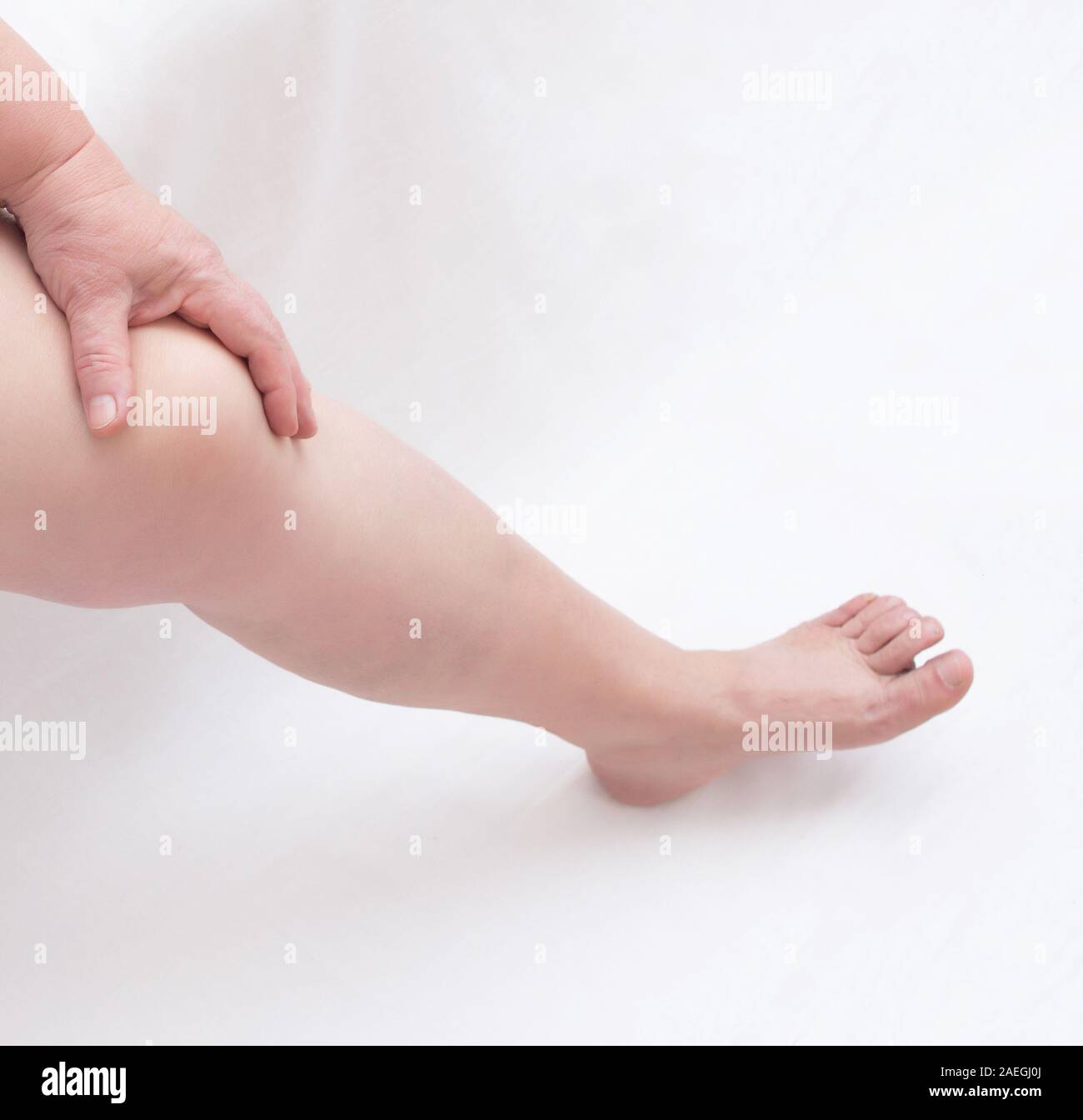 Woman holds on to a sore leg on a white background. The concept of ...