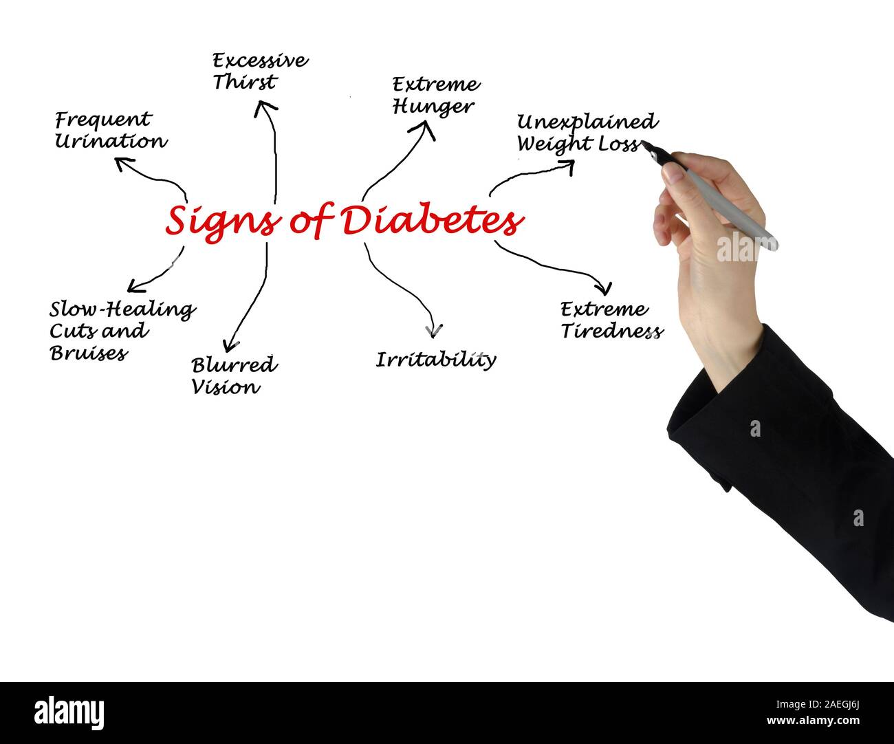 Sign of diabetes Stock Photo - Alamy