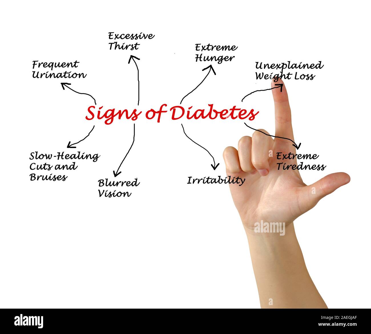 Sign of diabetes Stock Photo - Alamy