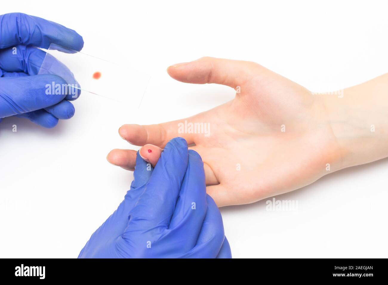 The doctor takes a biochemical blood test from a patient for a blood ...