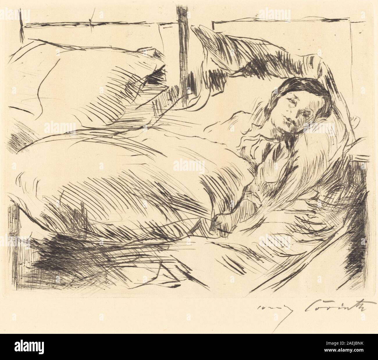 Painting by Lovis Corinth, 1918, depicting a sick child, showing facial ...