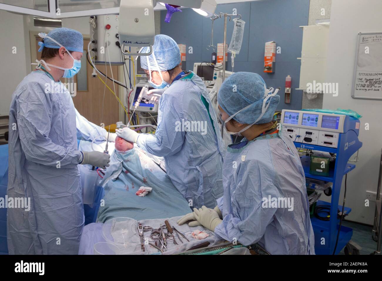 Surgeons at an NHS Hospital perform a knee operation, known as an ...