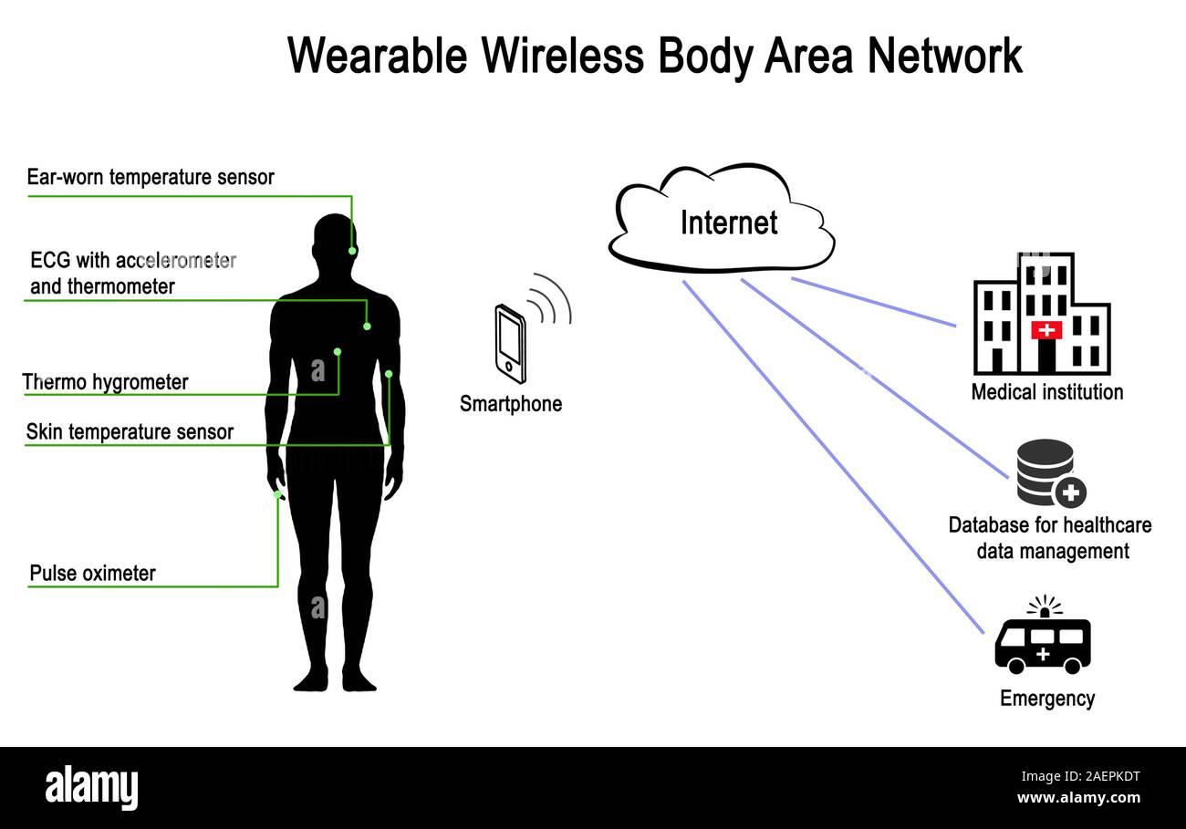 Thermo detection hi-res stock photography and images - Alamy