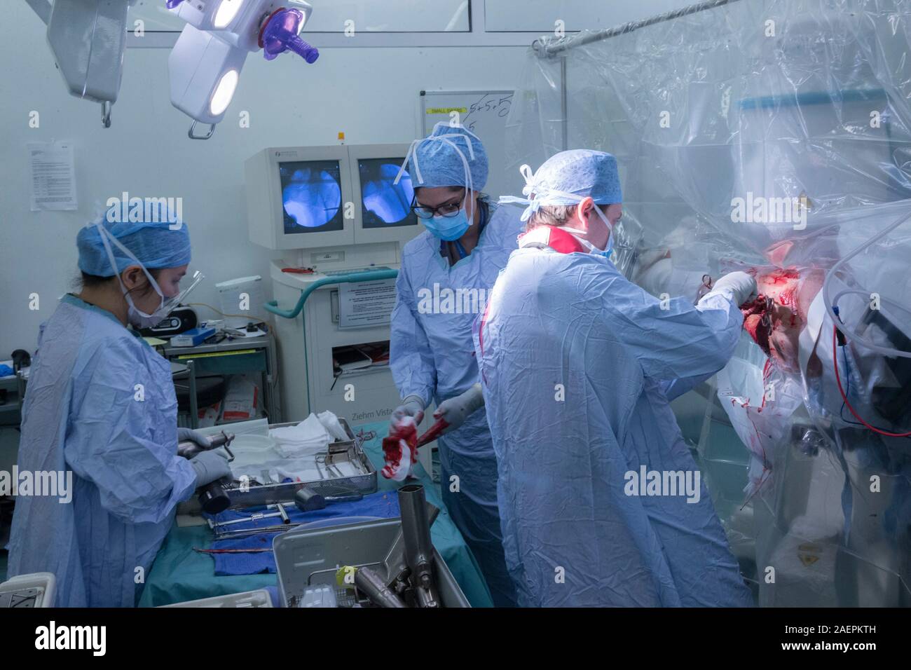 Joint replacement operation hi-res stock photography and images - Alamy