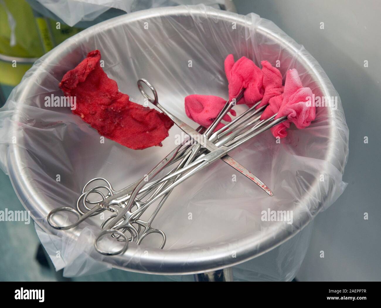 Used swabs in a dish in an operating theatre during an operation at an ...