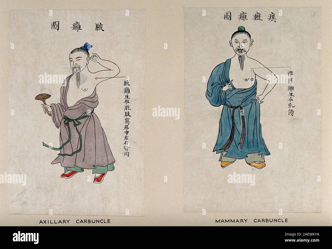 Carbuncle art hi-res stock photography and images - Alamy