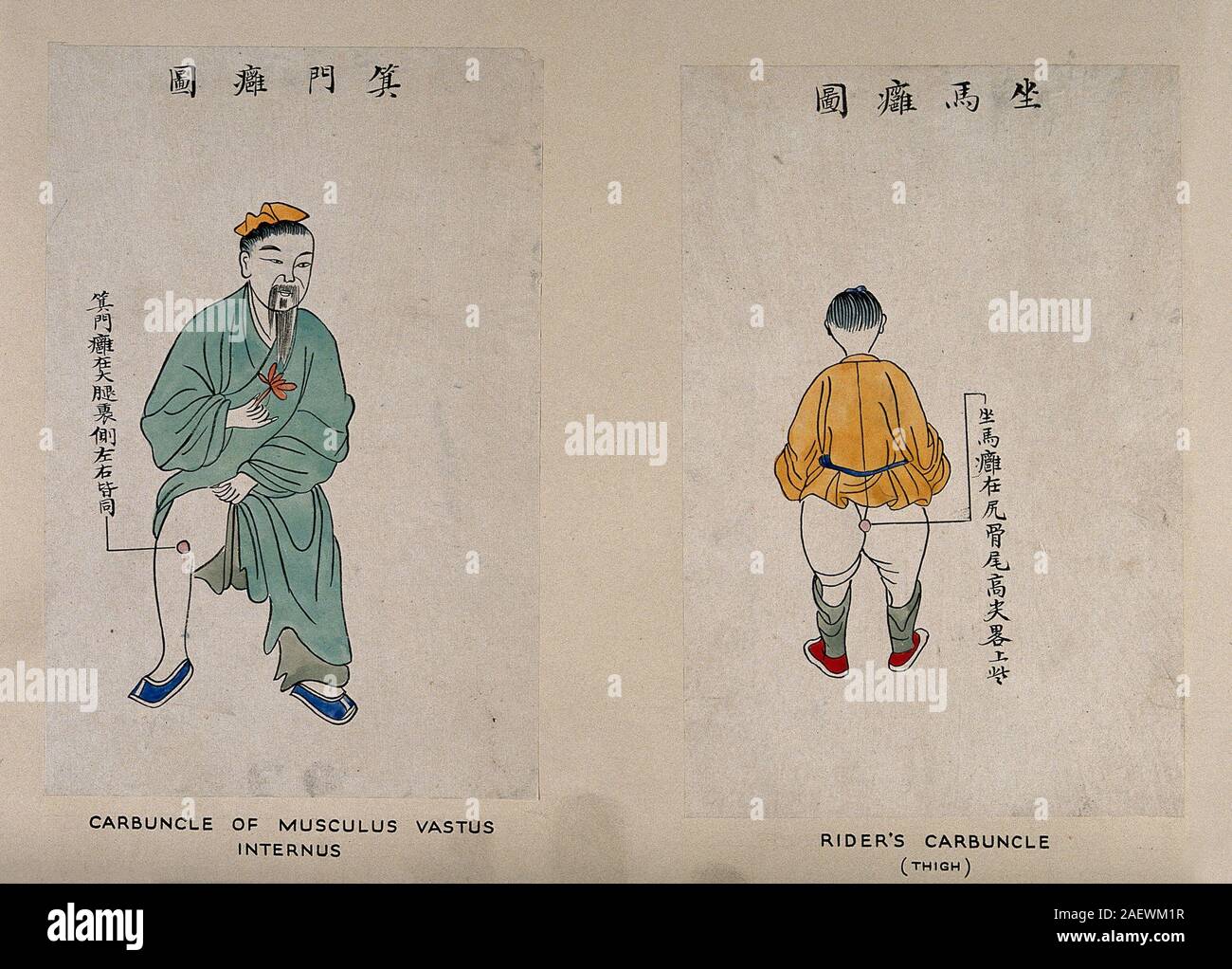 Carbuncle art hi-res stock photography and images - Alamy