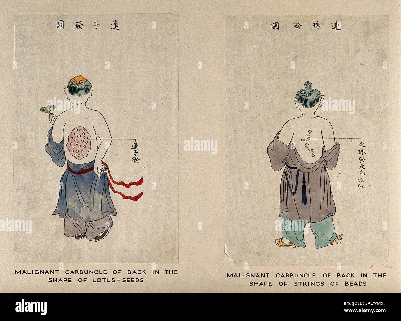 Carbuncle Art High Resolution Stock Photography and Images - Alamy