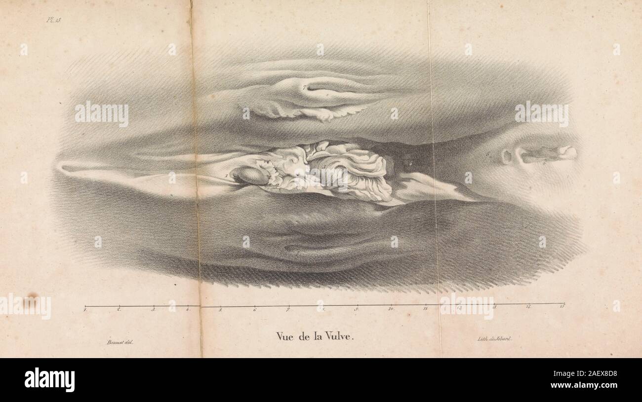 Genital organs hi-res stock photography and images - Alamy