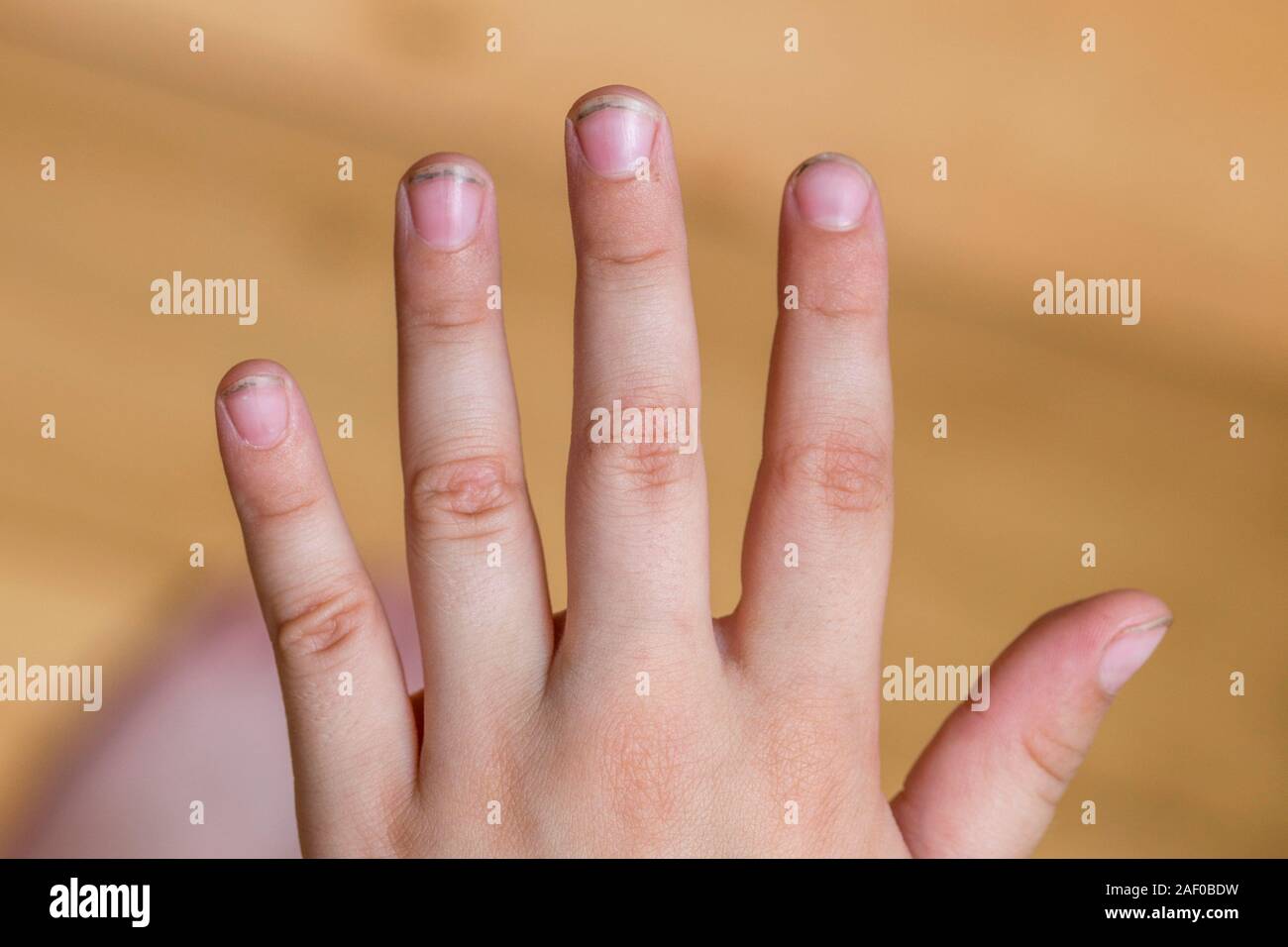Dirty long nails have germs make sick. Dirt under the nails of a child ...