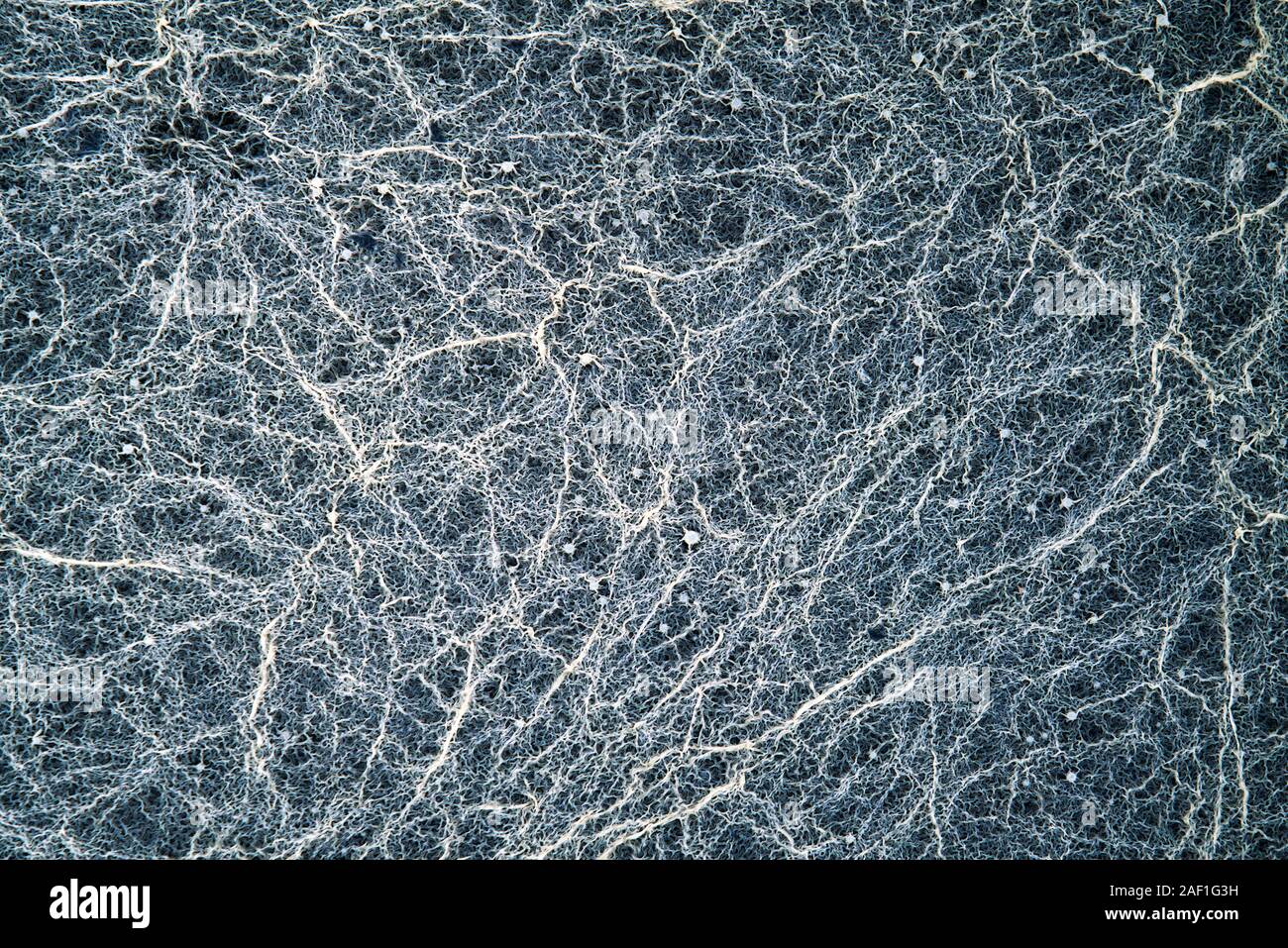 Brettanomyces yeast growing rapidly on sugars in a wine and beer making ...