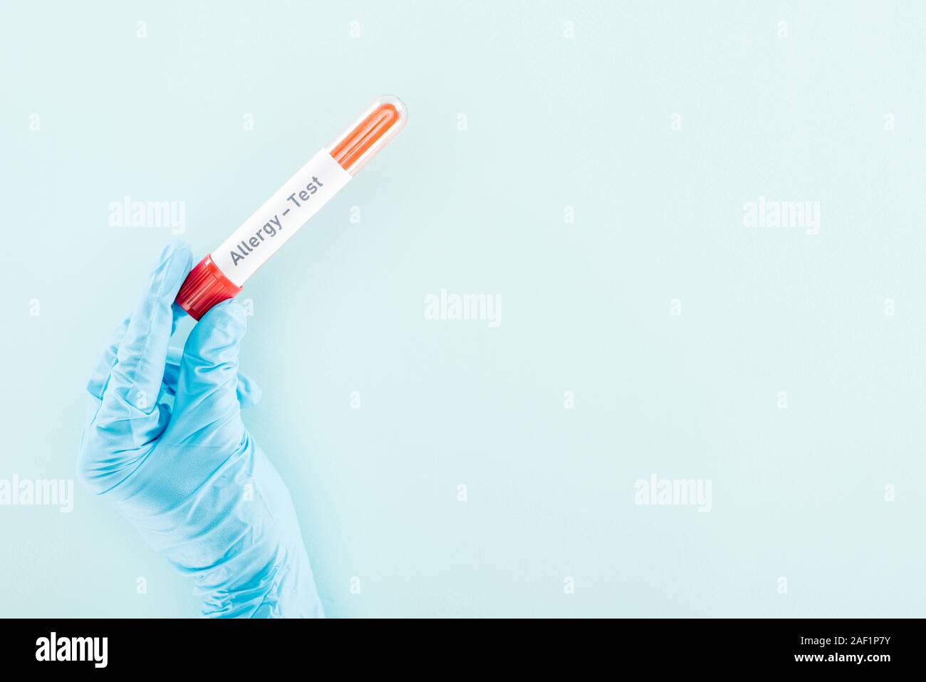 cropped view of doctor holding sample in test tube with allergy test ...