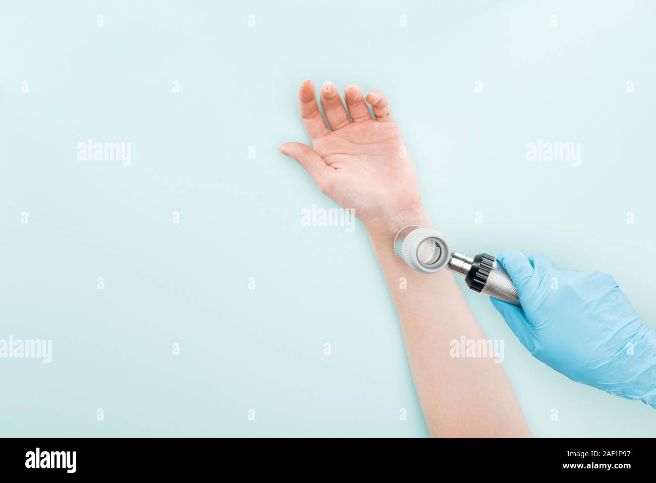 Dermatoscope hi-res stock photography and images - Alamy