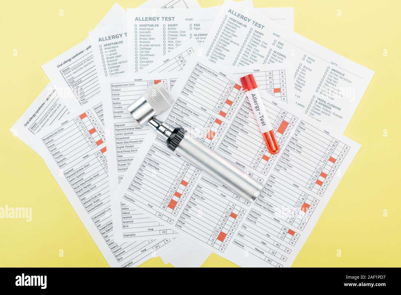 top view of test tube with allergy test lettering and dermatoscope on ...
