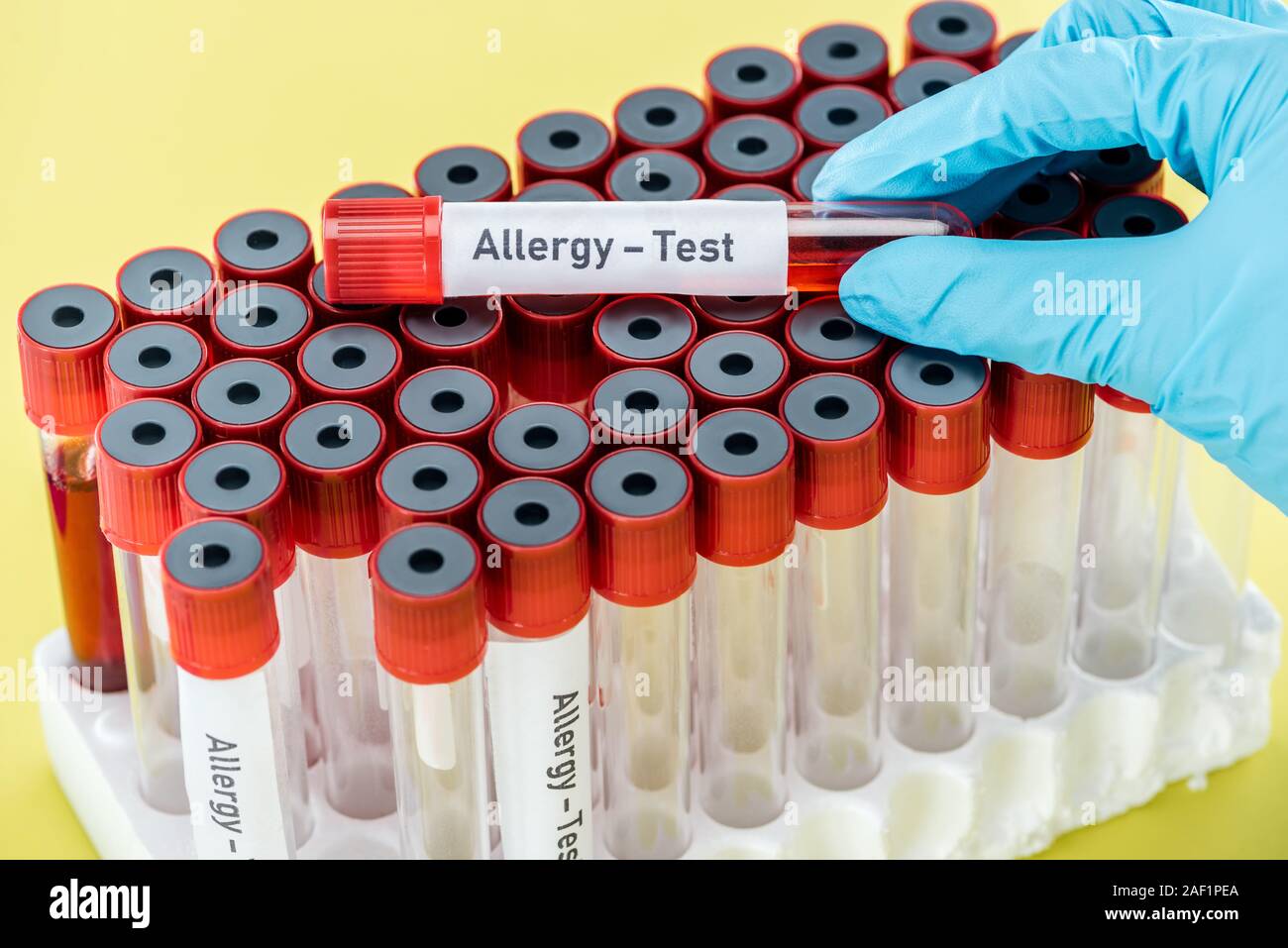 Empty test tubes hi-res stock photography and images - Alamy