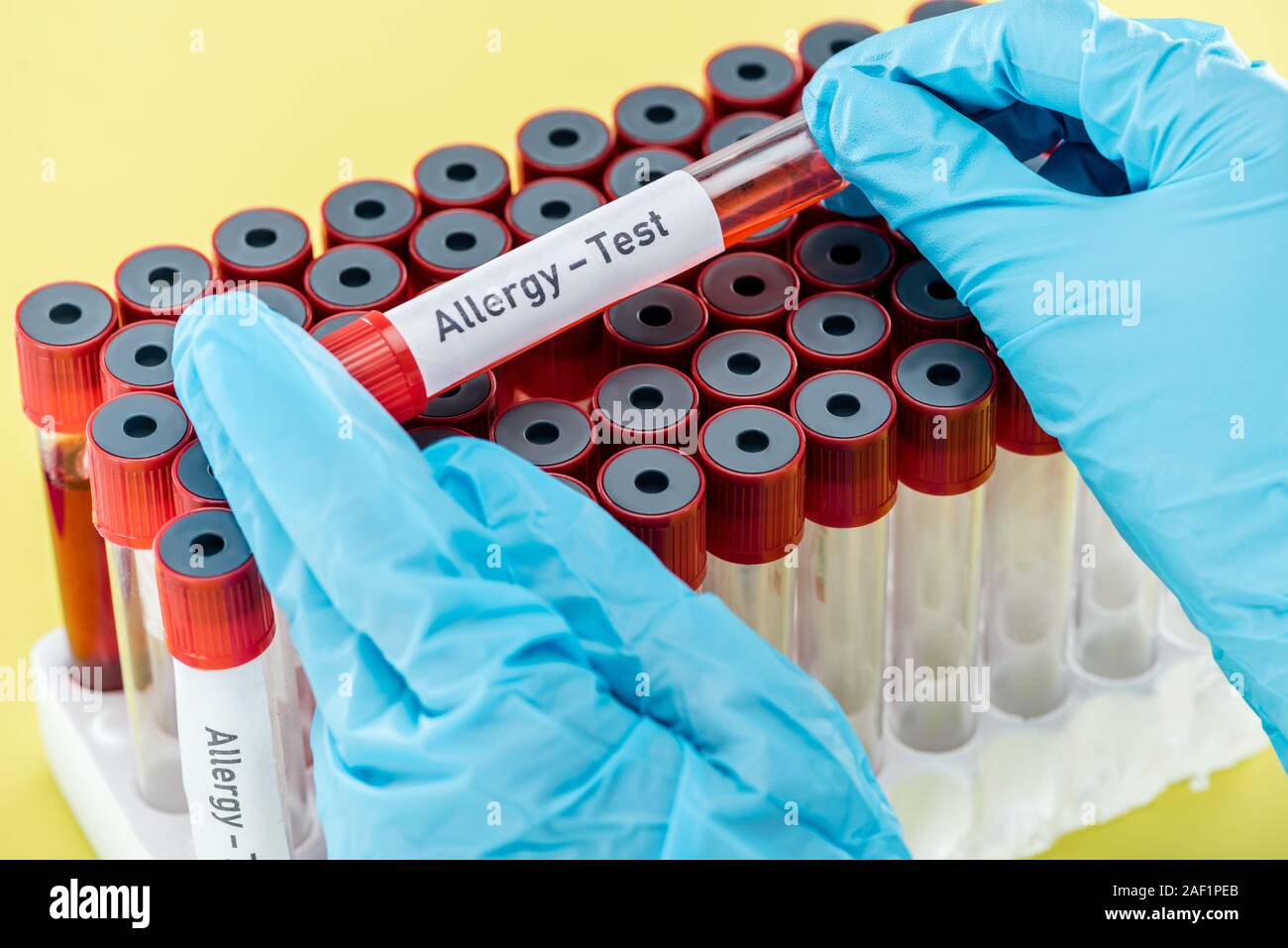 Empty test tubes hi-res stock photography and images - Alamy