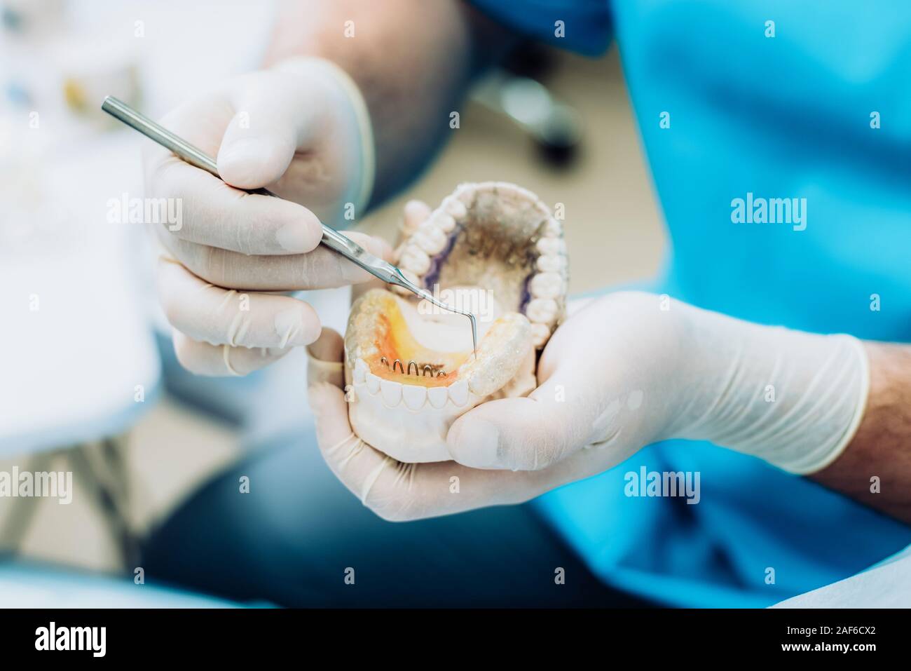 Orthodontic plate hi-res stock photography and images - Alamy