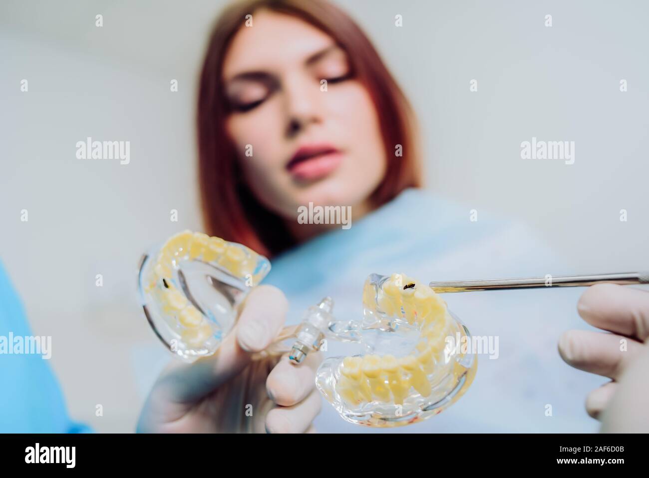 the orthodontist shows the carious cavity in the patient's chewing ...