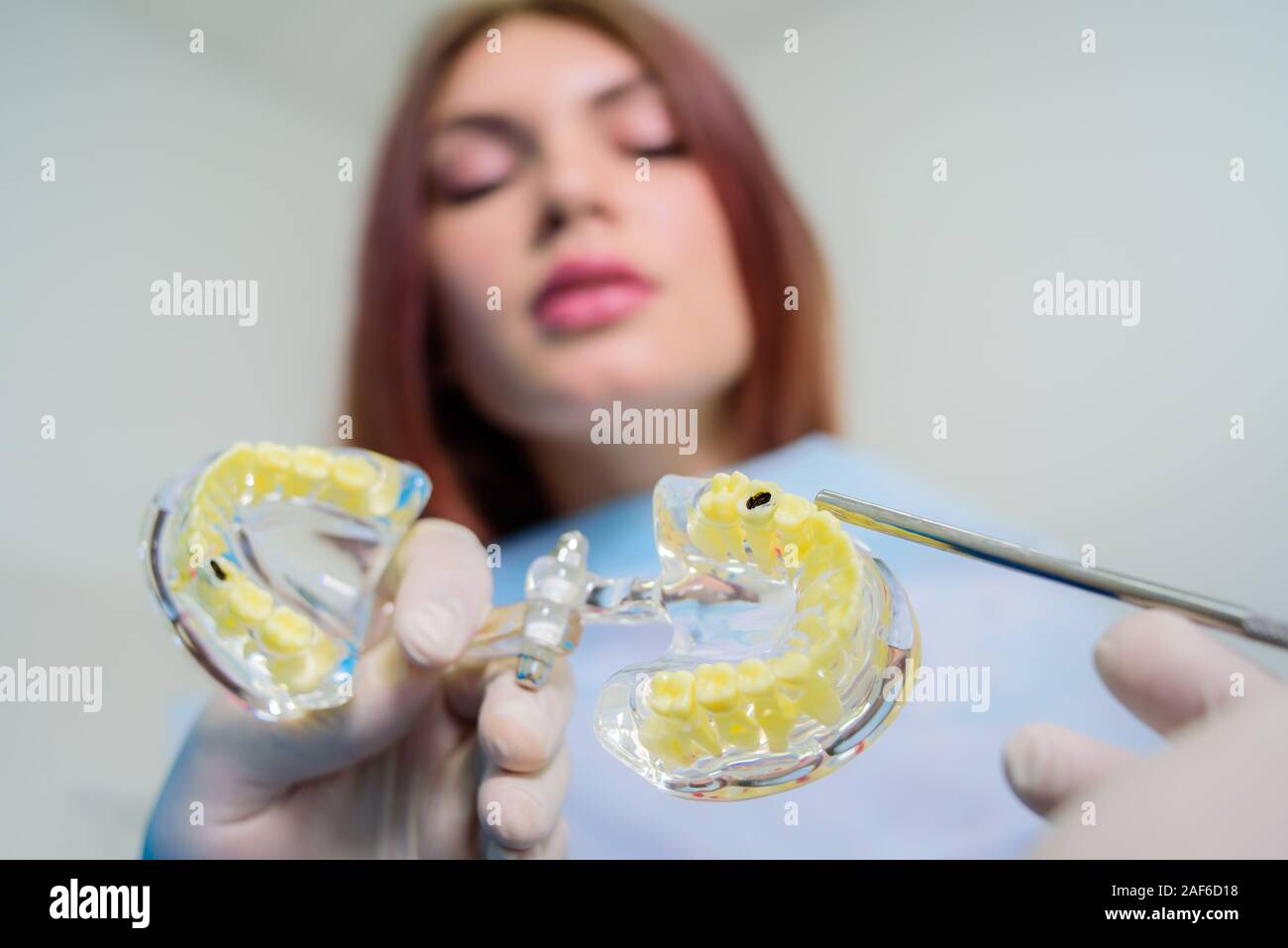 the orthodontist shows the carious cavity in the patient's chewing ...