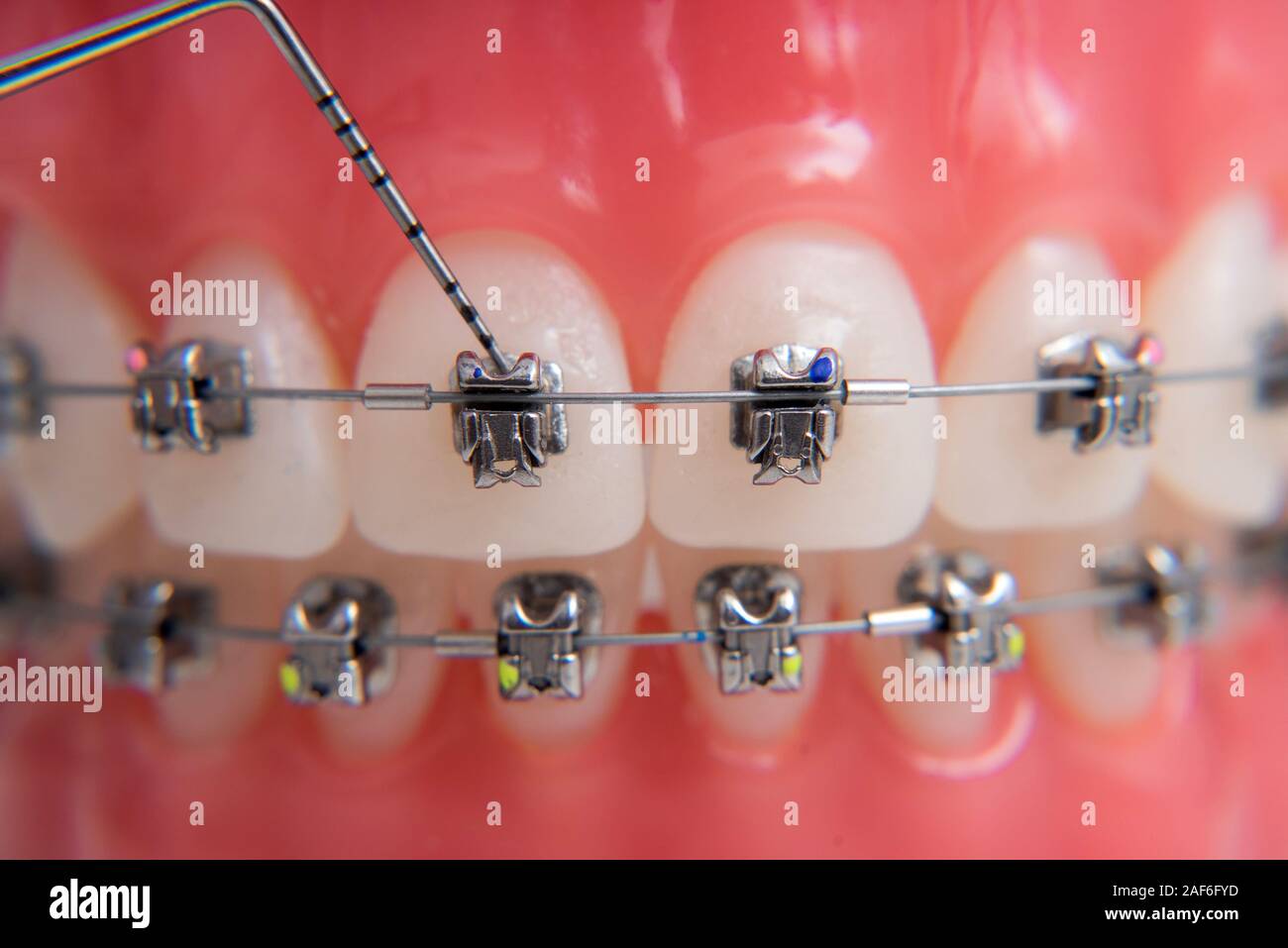 macro photography shows how the braces are arranged Stock Photo - Alamy