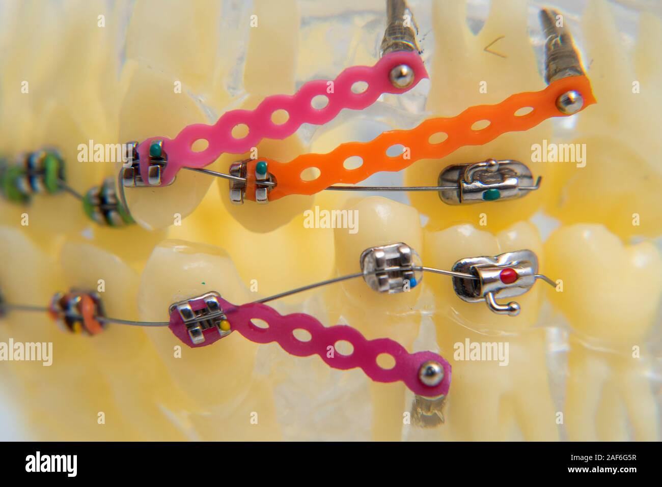 macro photography shows how the braces are arranged Stock Photo - Alamy