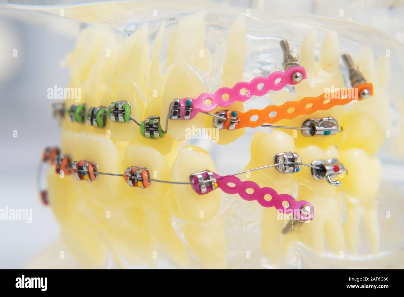 macro photography shows how the braces are arranged Stock Photo - Alamy