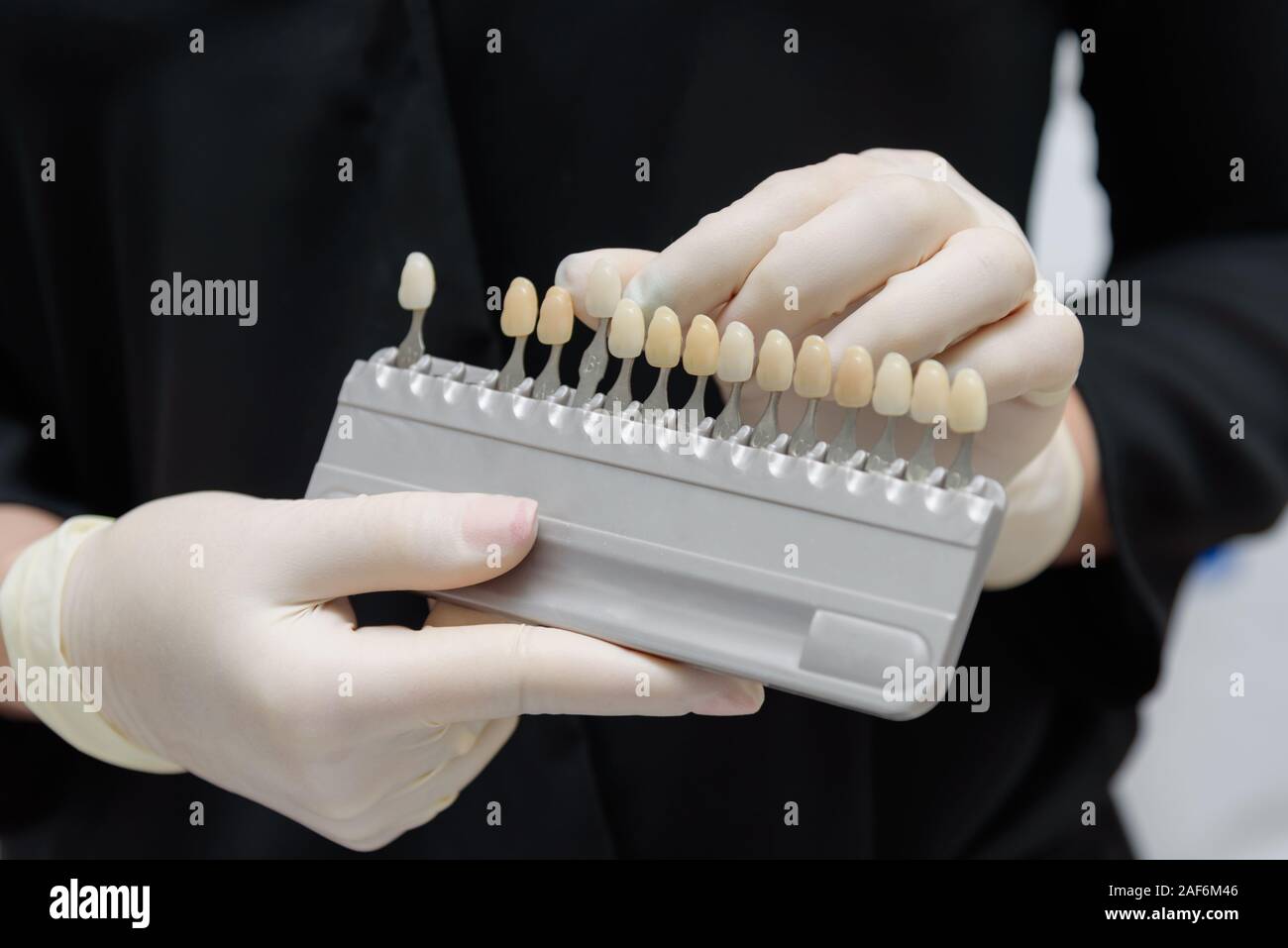 The doctor holds in his hand tests for the patient's teeth before ...