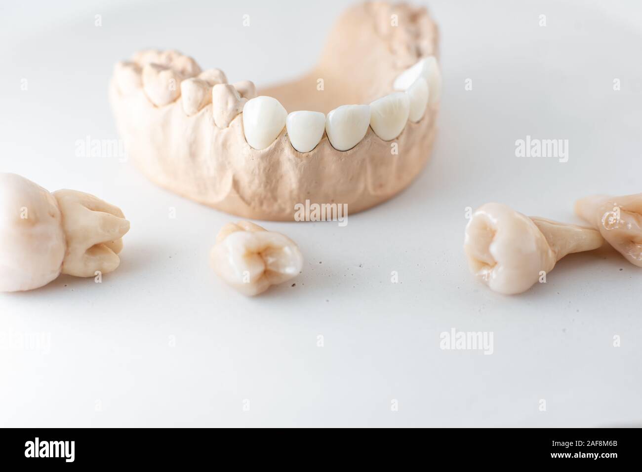 Close-up on plaster model of artificial jaw and teeth on the white ...