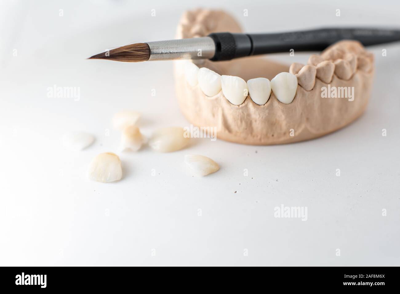 Human teeth mold hi-res stock photography and images - Alamy