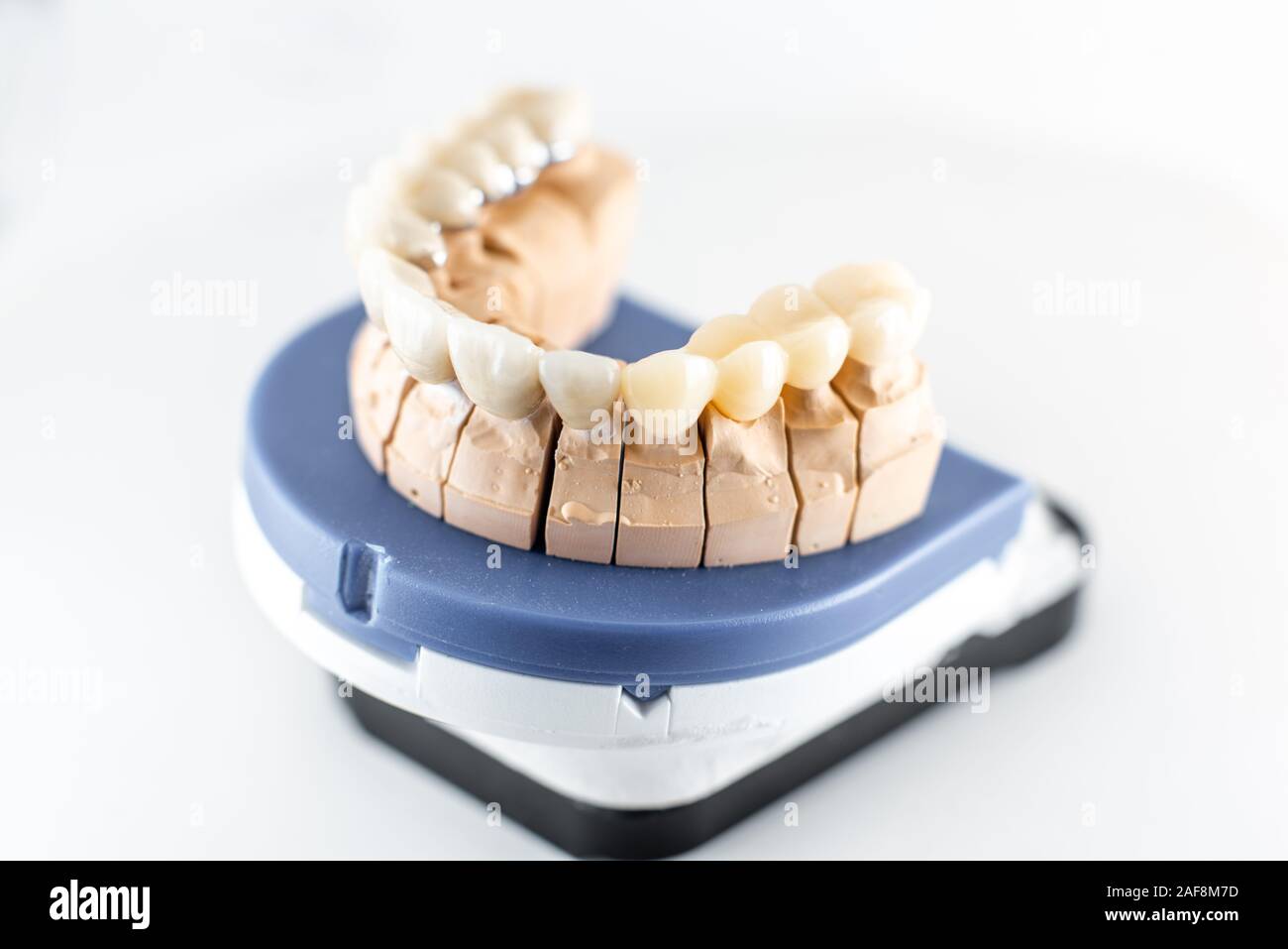 Cose up studio shot of dental imprint with artificial teeth on a dental ... Cose up studio shot of dental imprint with artificial teeth on a dental ...