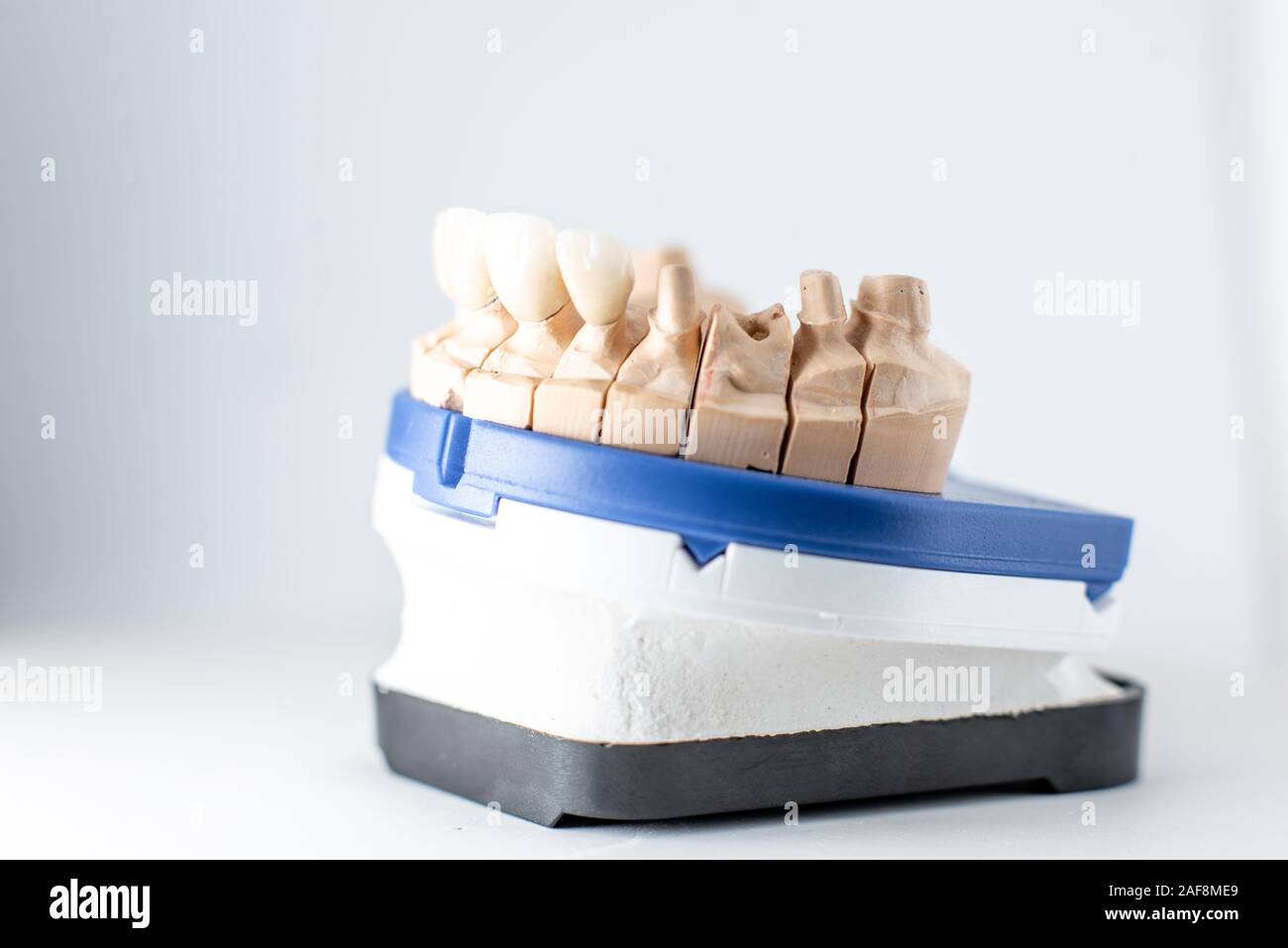 Cose up studio shot of dental imprint with artificial teeth on a dental ...
