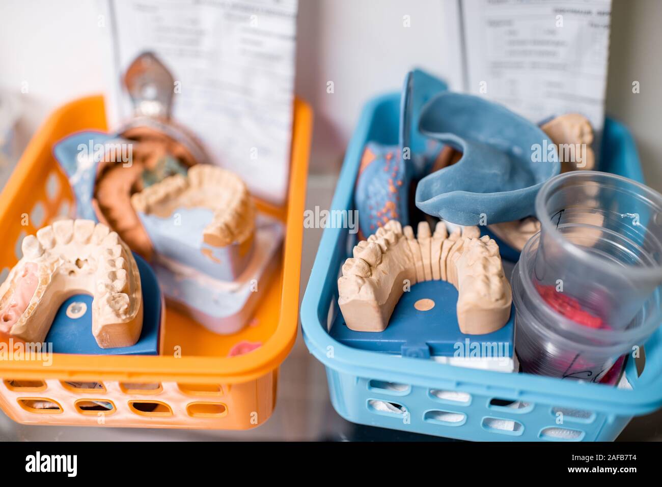 Various of artificial jaw models, impressions and dental implants on ...