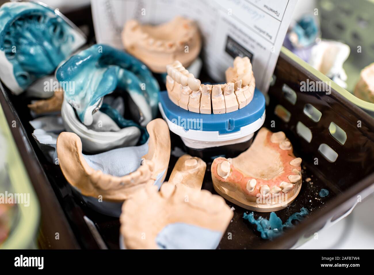 Various of artificial jaw models, impressions and dental implants on ...