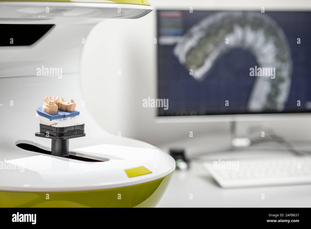 Denture scan hi-res stock photography and images - Alamy