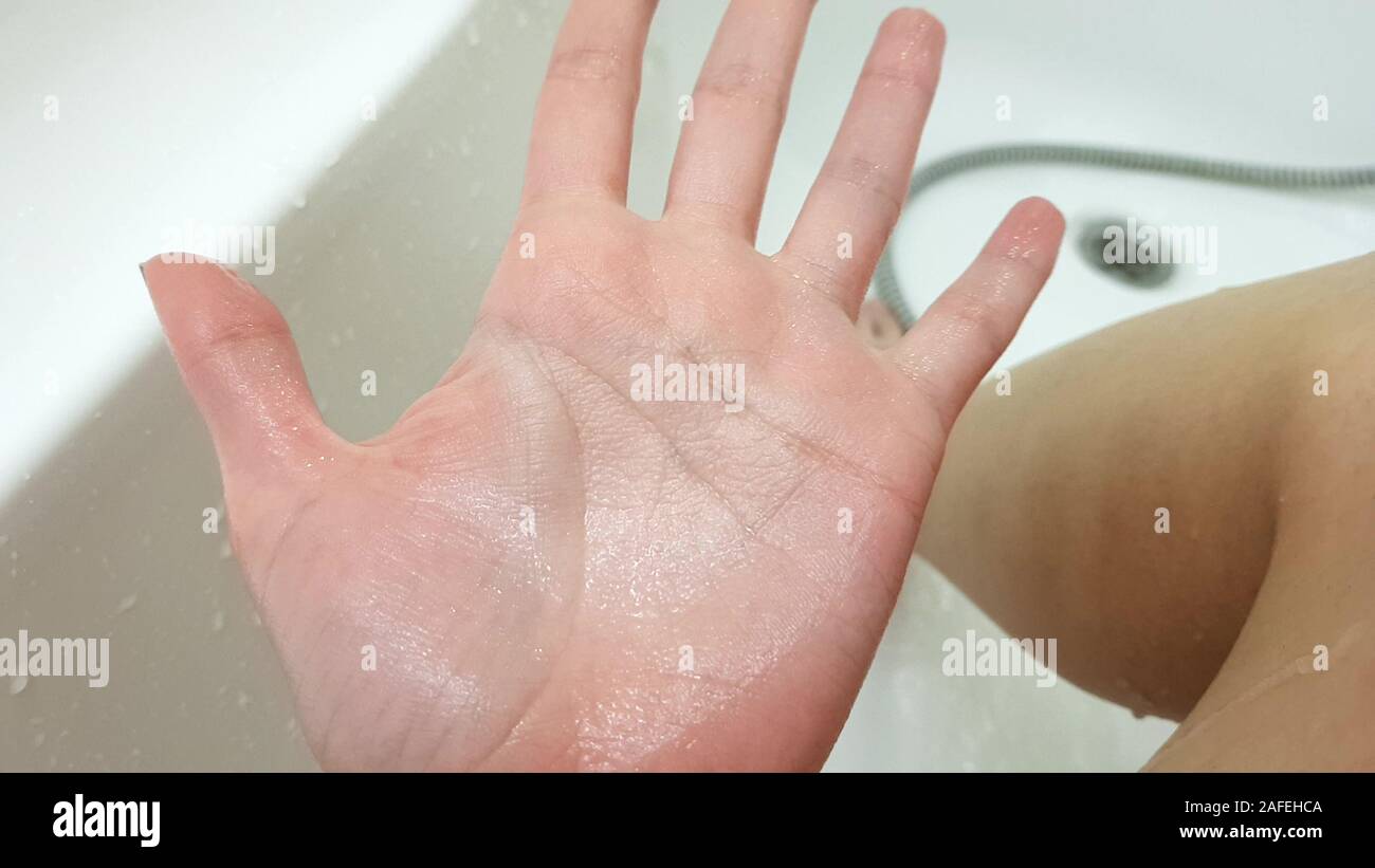 Wrinkled female hand because of soak in the water for a long time, wet ...