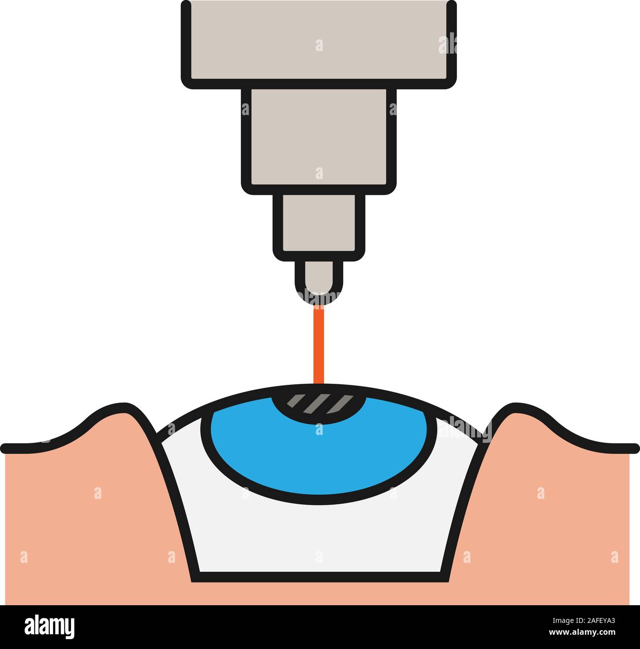 Laser eye surgery color icon. Medical ophthalmology. Laser vision ...