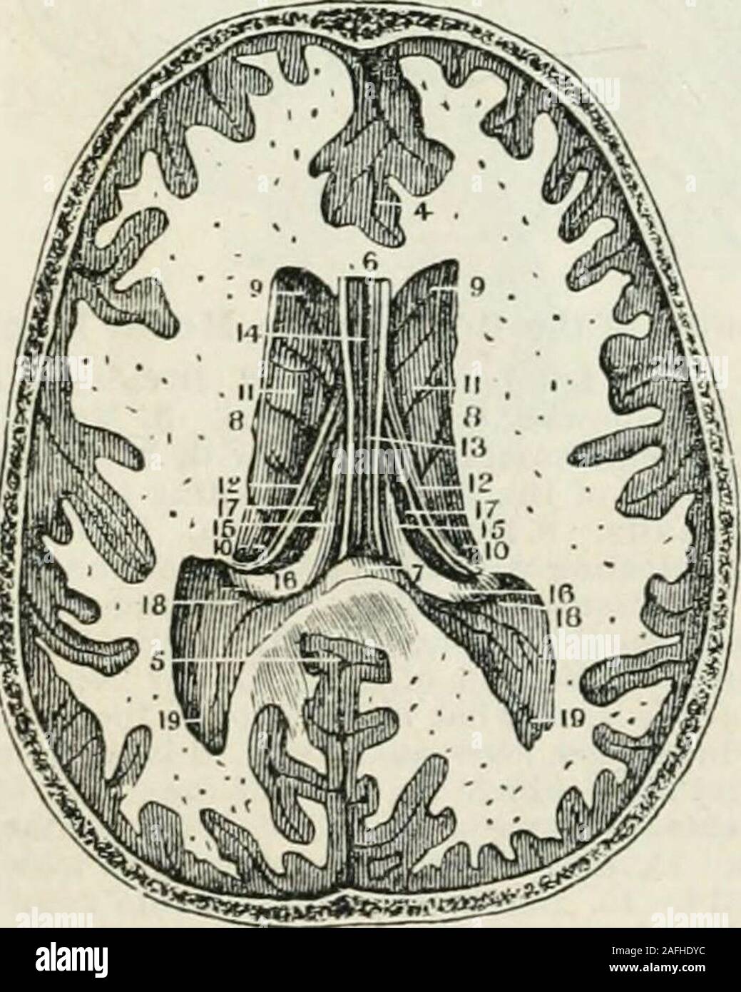 Brain transverse section hi-res stock photography and images - Alamy