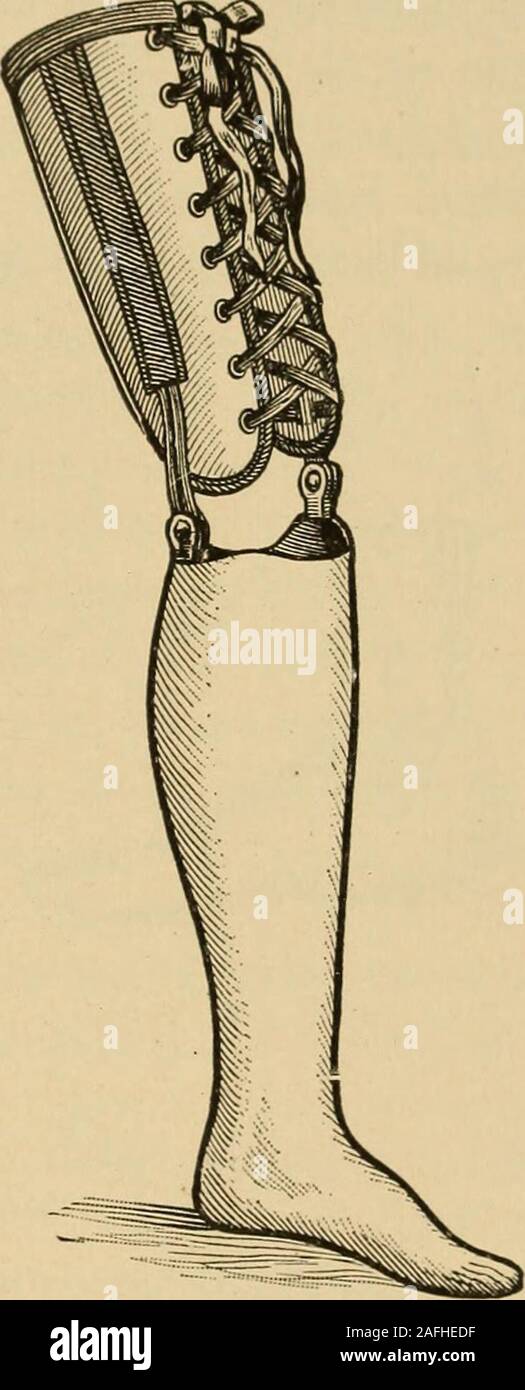 Below knee amputation stump hi-res stock photography and images - Alamy