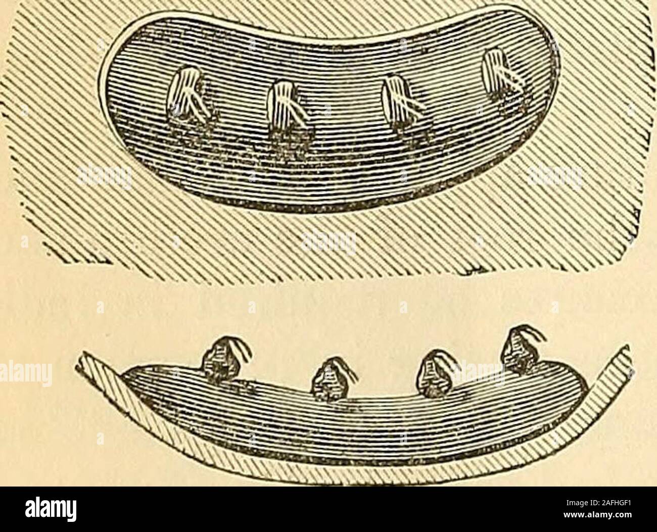 . The principles and practice of surgery. Fig. 464 gives front and side ...