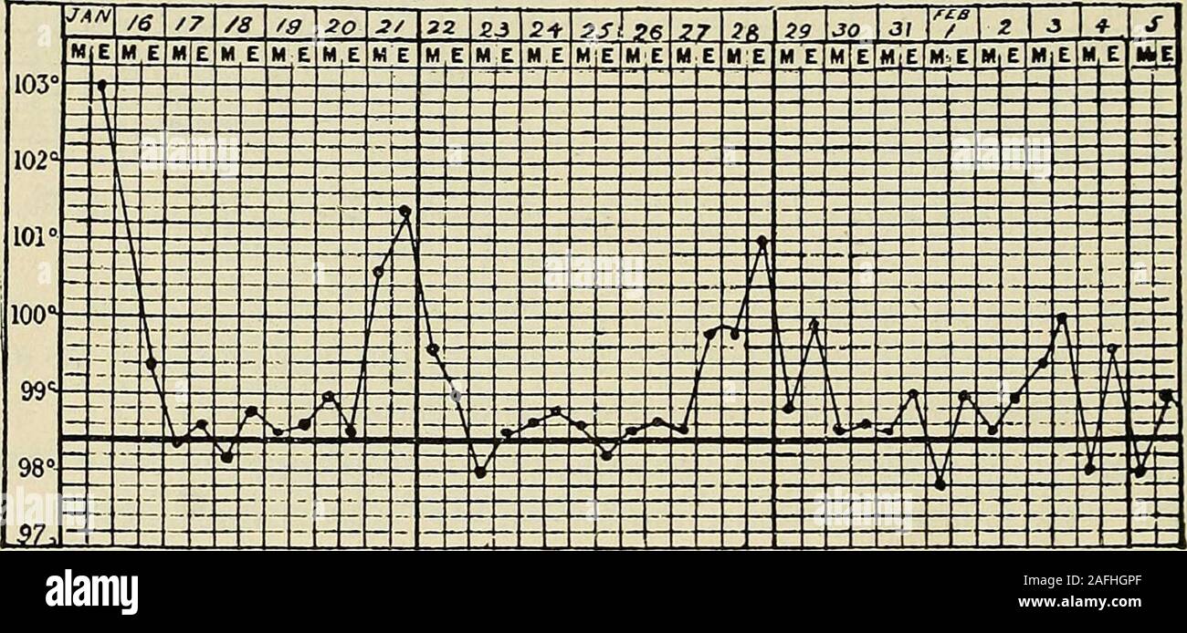 Trench fever hi-res stock photography and images - Alamy