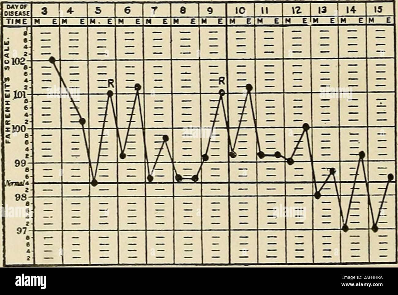 Trench fever hi-res stock photography and images - Alamy