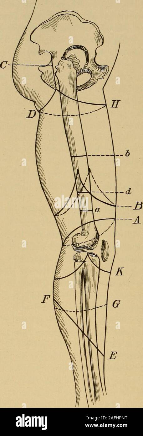 Thin stumps hi-res stock photography and images - Alamy